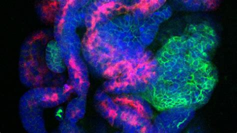 Nuevo Método Para Cultivar Y Mantener Células Precursoras Del Riñón