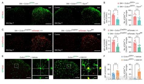 慢性疼痛难忍？胡宏镇团队揭示神经病理性疼痛新机制，发现新治疗靶点 知乎