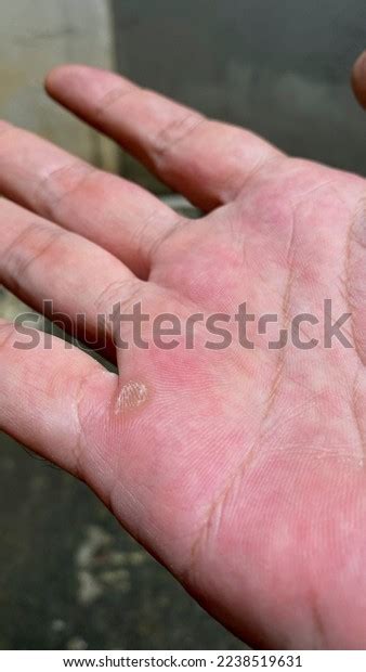 Detail Calluses On Palm Stock Photo 2238519631 Shutterstock