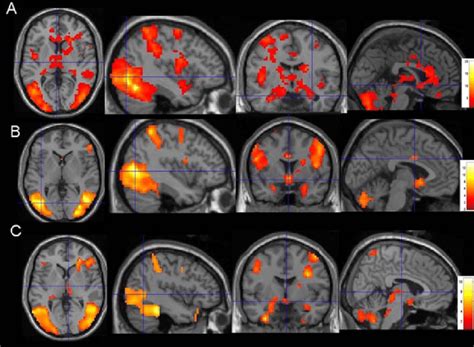 Statistical Parametric Maps Of Activation For All Subjects Viewing