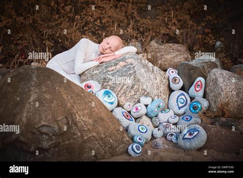 Young Hairless Girl With Alopecia In White Futuristic Costume Sleeping