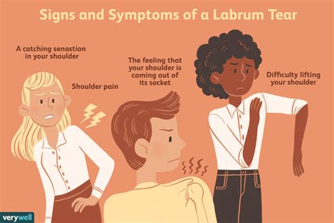 Physical Therapy For A Shoulder Labrum Tear