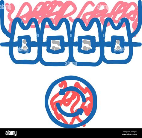 Lingual Tooth Braces Icon Doodle Illustration Stock Vector Image And Art Alamy