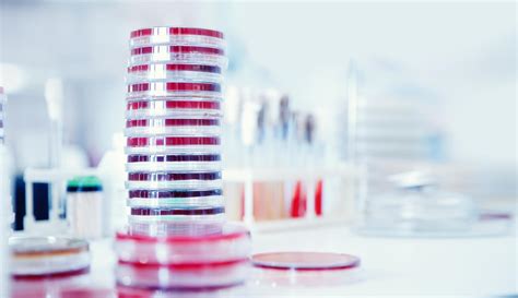 Microbiology Testing Tentamus California