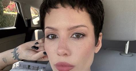 Qué Es El Lupus Una De Las Enfermedades Que Sufre La Cantante Halsey