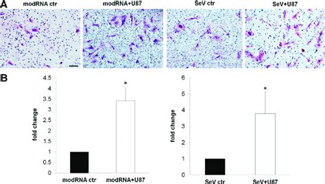 Hipsc Derived Astrocytes Maintain Stem Cell Like Migration Download Scientific Diagram