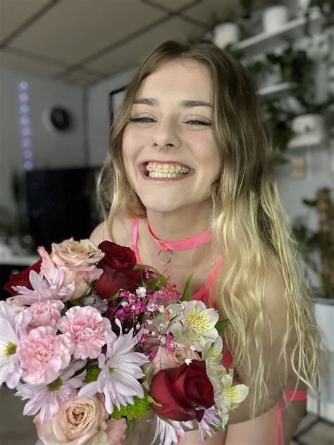 I Love Braces Rilovebraces