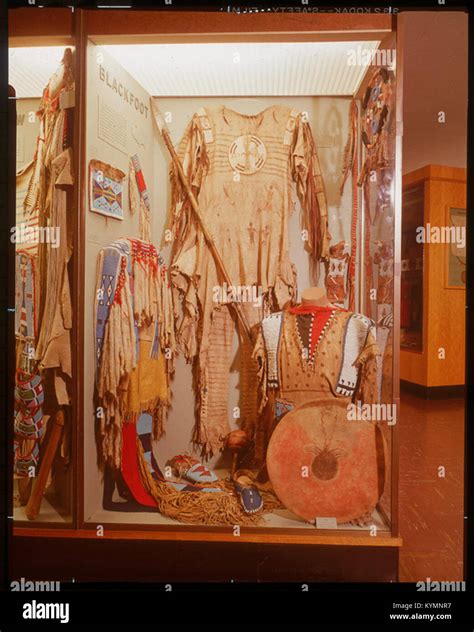 A Transparency Image Depicting An Unknown Subject Showing Clear Detail