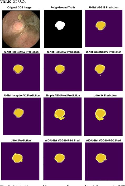 Figure From A CNN Architecture For Detection And Segmentation Of Colorectal Polyps From CCE