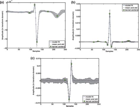 Fully Automatic Modeling Of Ecg Signals As Mixture Of A Finite Number