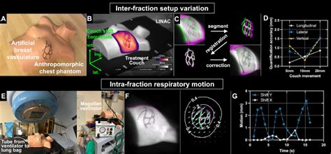Cherenkov Imaged Bio Morphological Features Verify Patient Positioning With Deformable Tissue