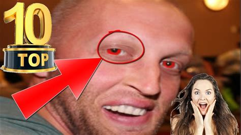 Top 10 Most Common Ectodermal Dysplasias With Zumbaza Tv Youtube