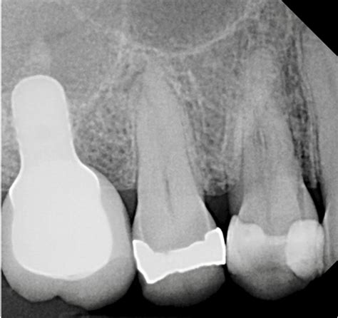 Online Dental Ce Webinars And Events Article Null Dentalxp