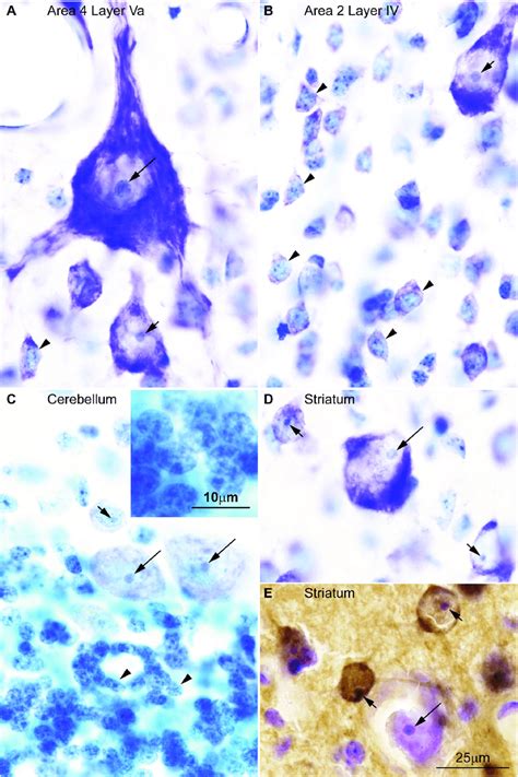 Chromatin Patterns Shown By Nissl Are Not Related To Neurotransmitter
