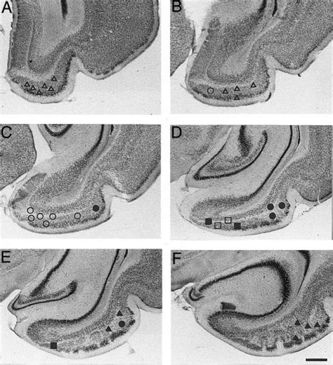 a f recording sites reconstructed after histological verification of