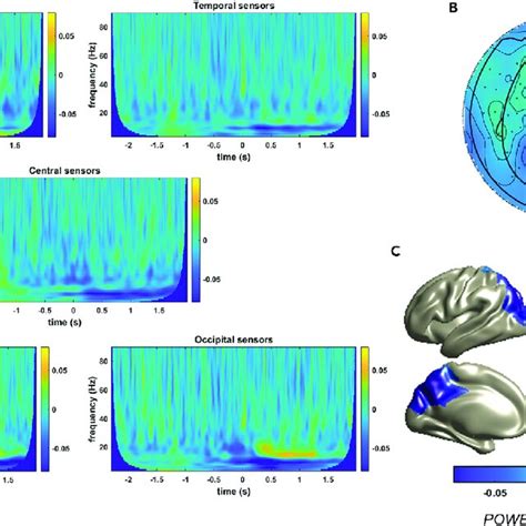 A Band Desynchronization Locked To Saccadic Response Onset A Group