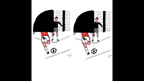 Visual Field Defects Youtube