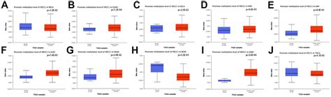 Xrcc1 A Potential Prognostic And Immunological Biomarker In Lgg Based