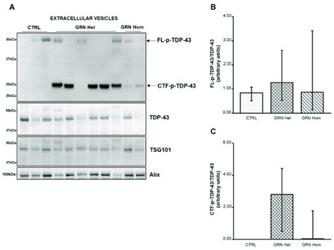 Tdp 43 Content In Evs Isolated From Lcls From Wt Controls And