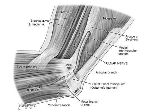 Ulnar Nerve Entrapment Medial Epicondylitis At Bruce Harris Blog