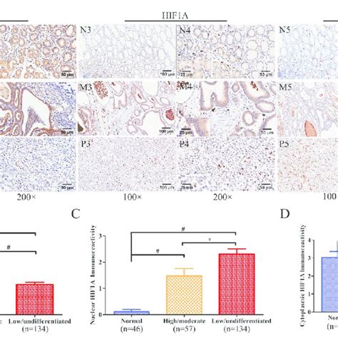 Pdf Down Regulation Of Rna Binding Motif Single Stranded Interacting