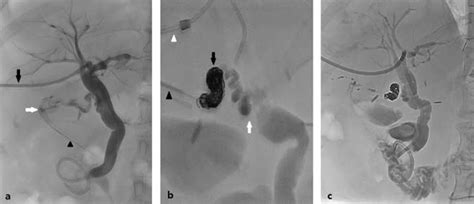 Vol 19 No 10 2025 Journal Of Radiology Case Reports