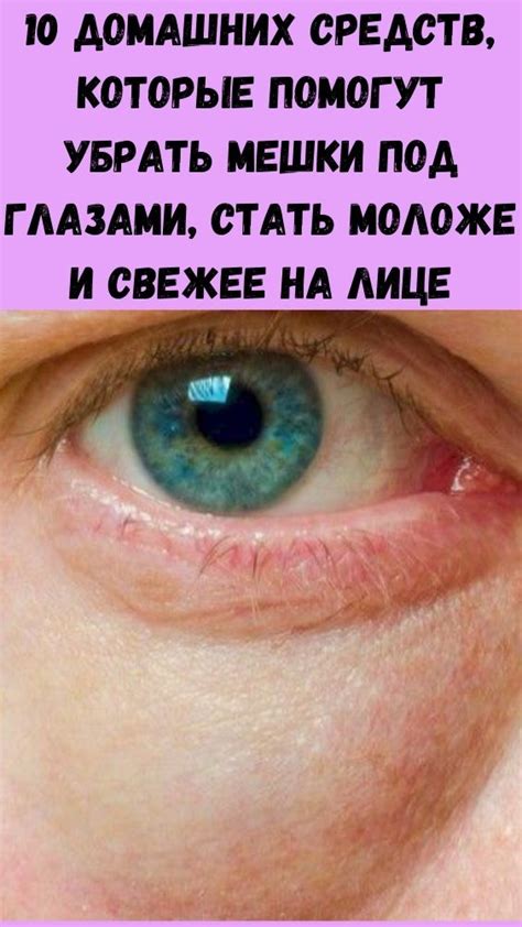10 домашних средств, которые помогут убрать мешки под глазами, стать ...