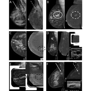 Representative Normal CEM Study With Standard Views Showing The Low Download Scientific