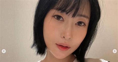 이세영 맞아 코 성형수술 후 물오른 미모 눈길