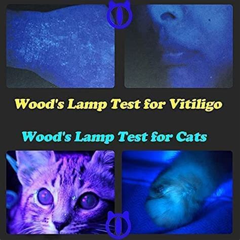 Wood Lamp Skin Analyzer And Magnifying Lamp Professional Woods Lamp Eye