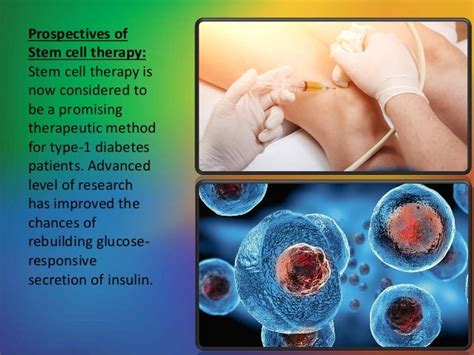 The Latest Procedure Of Stem Cell Therapy For Type 1 Diabetes Mellitus