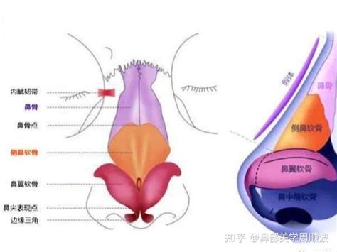 自体软骨该如何选择？ 知乎