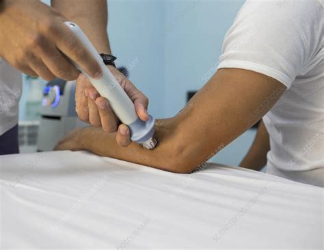Shockwave Therapy Stock Image F0365798 Science Photo Library