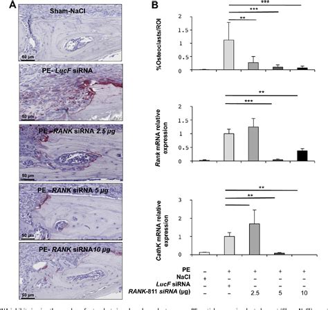 Table 1 From Inhibition Of Osteolysis And Increase Of Bone Formation