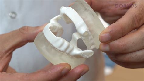Los dispositivos de avance mandibular para la apnea del sueño
