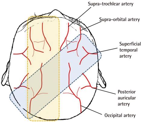Various Types Of Bipedicled Pericranial Flaps With Sufficient Arterial Download Scientific