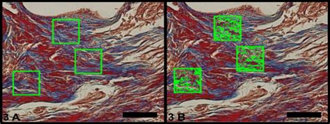 Photomicrographs Of Histomorphometric Analysis Quantification Of The Download Scientific