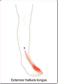 Extensor Hallucis Longus Physiopedia