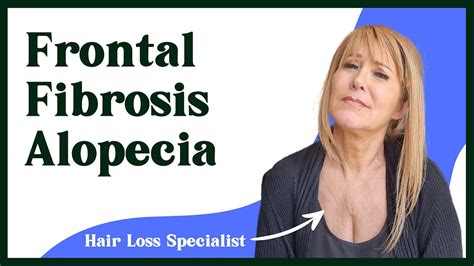 Frontal Fibrosis Alopecia Hair Loss Specialist Responds