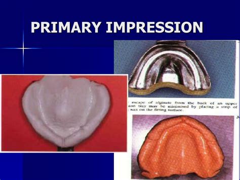 What Is Primary Impression In Dental At Philip Mayers Blog