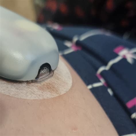 Constantly Leaking Pods Romnipod