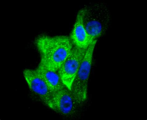 Cytokeratin 6 Rabbit Mab Sab Signalway Antibody