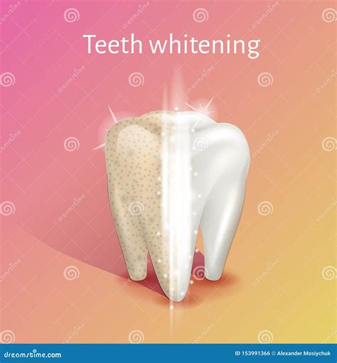 Tooth Whitening In Realistic 3d Vector Illustration Stock Vector