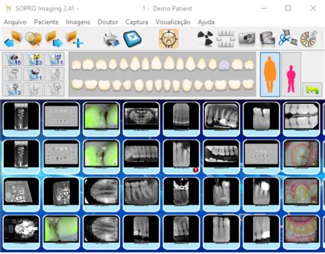 Sopro Imaging 2 41 Brasil