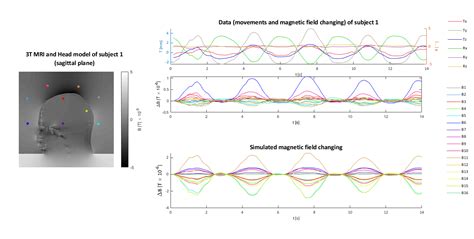 Left Field Simulation And Probe Positions For Subject
