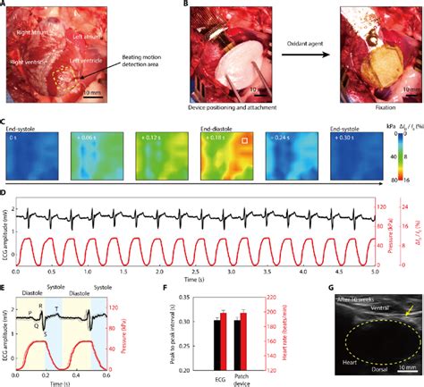Real Time Monitoring Of Cardiac Beating Motion In A Live Rabbit Model Download Scientific