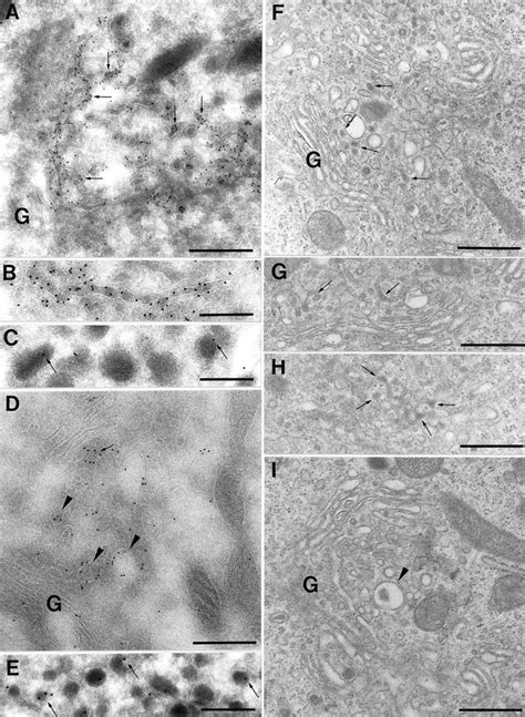 Ultrastructural Analysis Of Att 20 Cells Expressing Pam A E