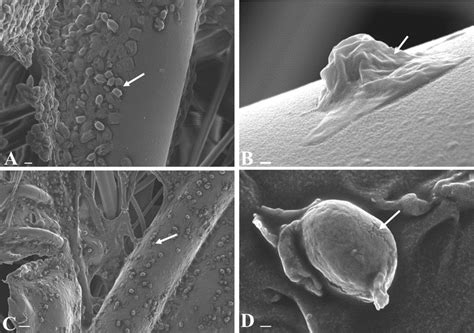 Scanning Electron Micrographs Of C Difficile Spores Present On Spiked