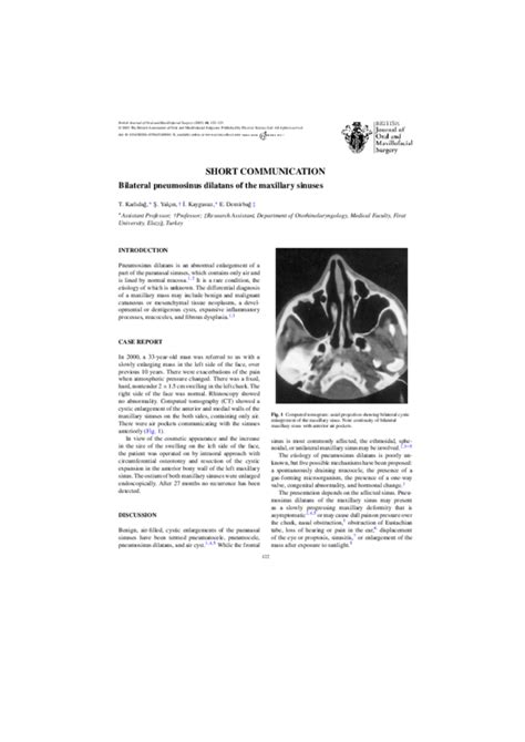 Pdf Bilateral Pneumosinus Dilatans Of The Maxillary Sinuses