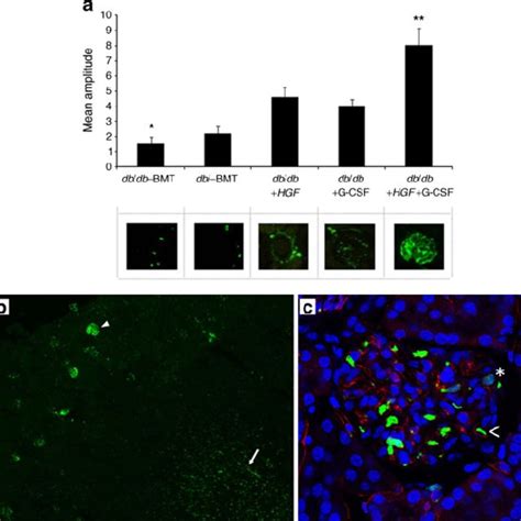 glomerular sclerosis in db db bmt and db db mice representative